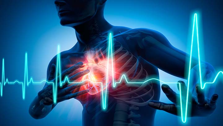 Avisos claro de que se aproxima una falla cardiovascular en los ...